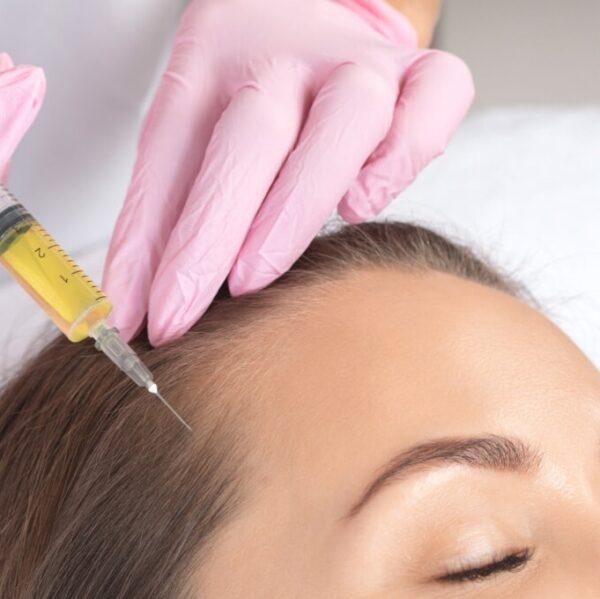 PRP vs. Stem Cell Exosome Treatments